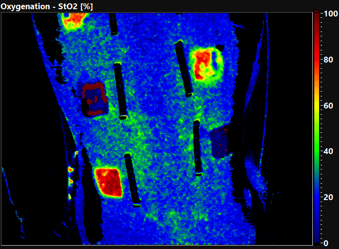Nicht-invasive bildgebende Verfahren zur Wunddokumentation » COREMED